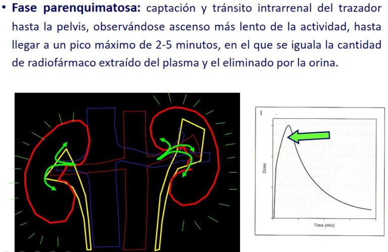 Protocolo de exploración de Renograma isotópico basal – diurético ...